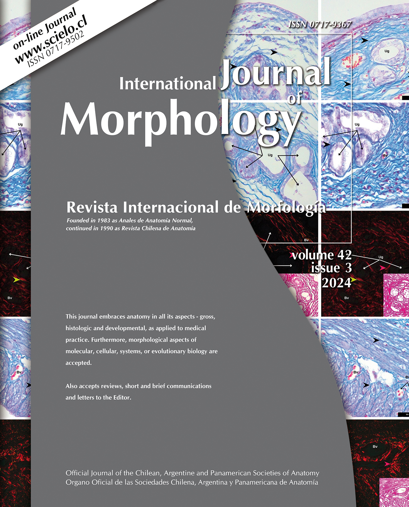 Relación entre el Seno Maxilar y Ápices de Dientes Postero- superiores ...